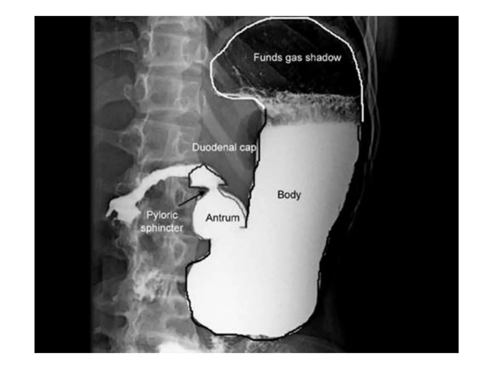 Radiographic anatomy of abdomen Region | PPTX