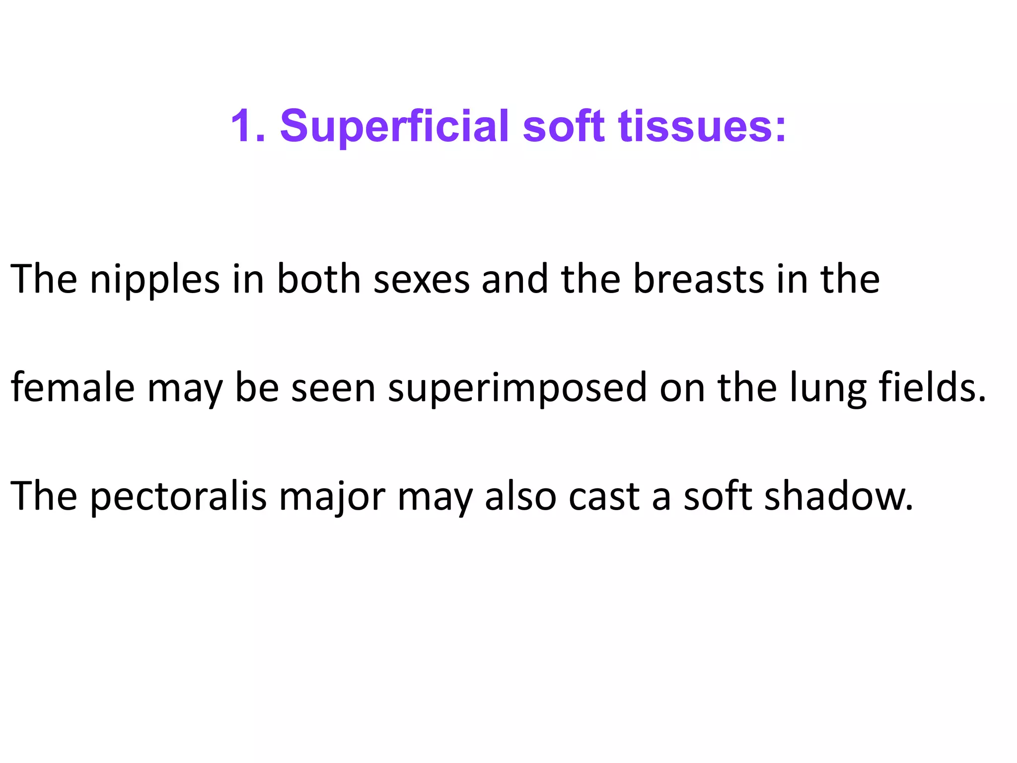 Radiographic anatomy of chest region | PPT