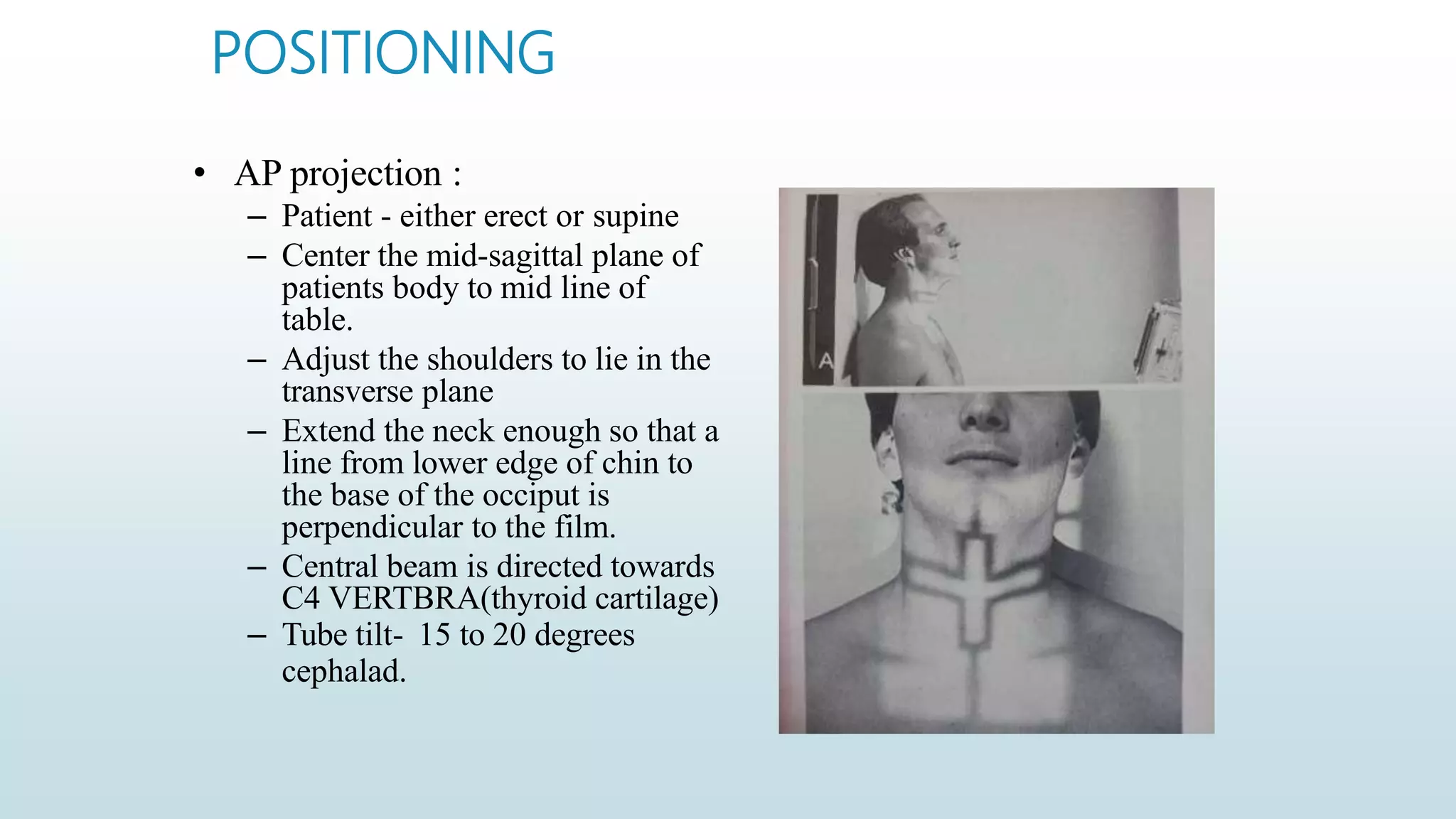 Radiographic anatomy and views of c spine | PPTX