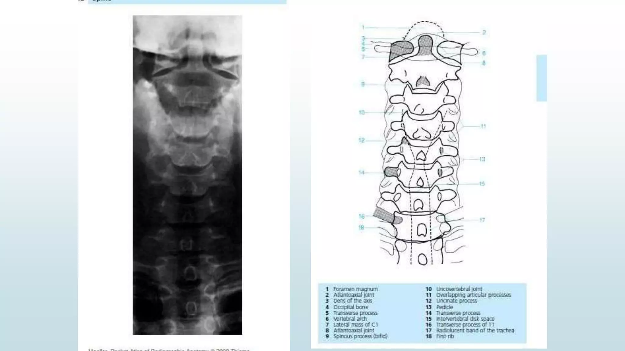 Radiographic anatomy and views of c spine | PPTX