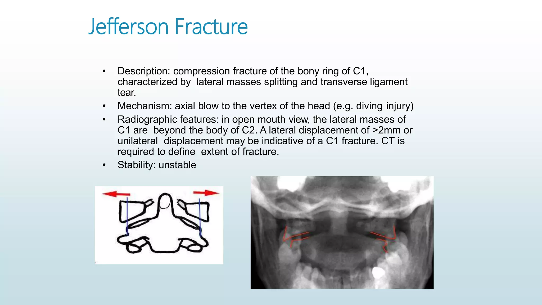 Radiographic anatomy and views of c spine | PPTX