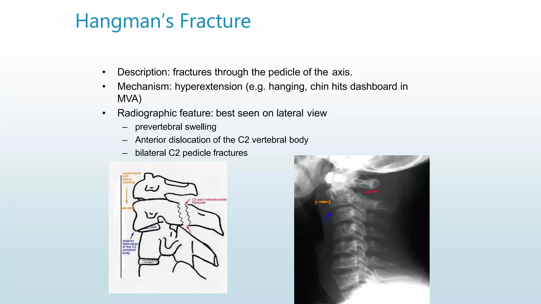 Radiographic anatomy and views of c spine | PPTX