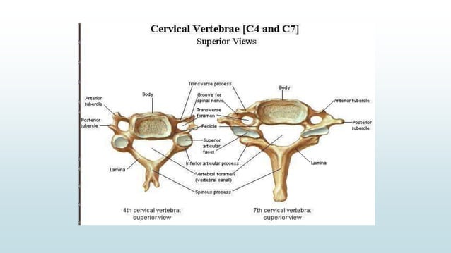 Radiographic anatomy and views of c spine | PPTX | Death, Injury, or ...