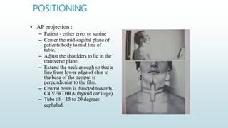 Radiographic anatomy and views of c spine | PPTX