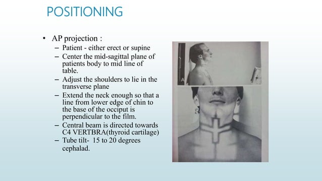 Radiographic anatomy and views of c spine | PPTX | Death, Injury, or ...