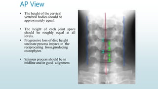 Radiographic anatomy and views of c spine | PPTX