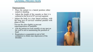 Radiographic anatomy and views of c spine | PPTX