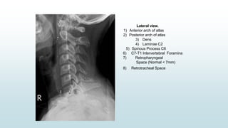 Radiographic anatomy and views of c spine | PPTX