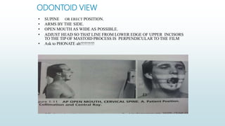 Radiographic anatomy and views of c spine | PPTX