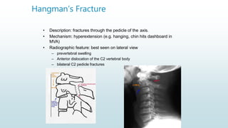 Radiographic anatomy and views of c spine | PPTX