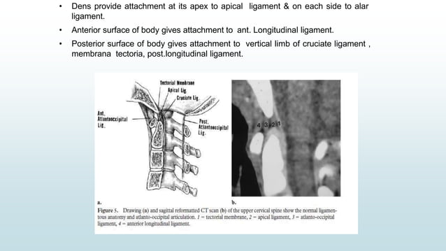 Radiographic anatomy and views of c spine | PPTX | Death, Injury, or ...