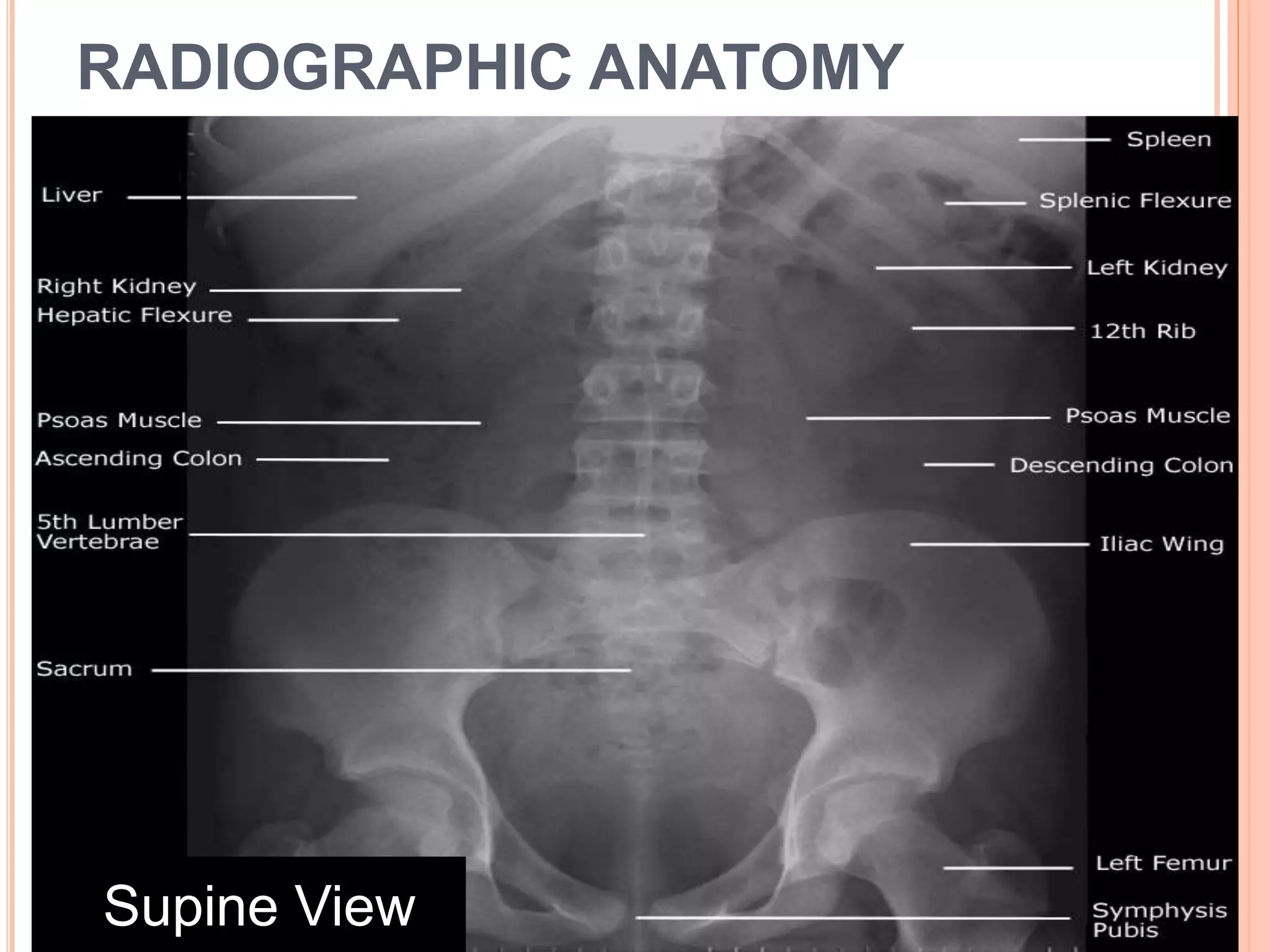 Radiographic Anatomy(chest abdomen and skeletal).pptx