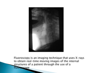 Radiographic anatomy of gastrointestinal tract | PPTX