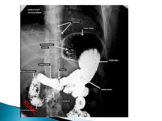 Radiographic anatomy of gastrointestinal tract