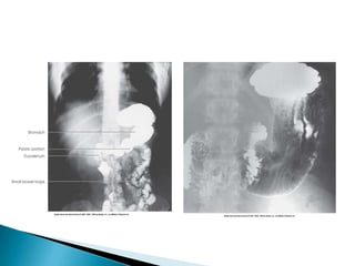 Gastrointestinal X Ray