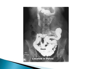 Radiographic Anatomy Of Gastrointestinal Tract