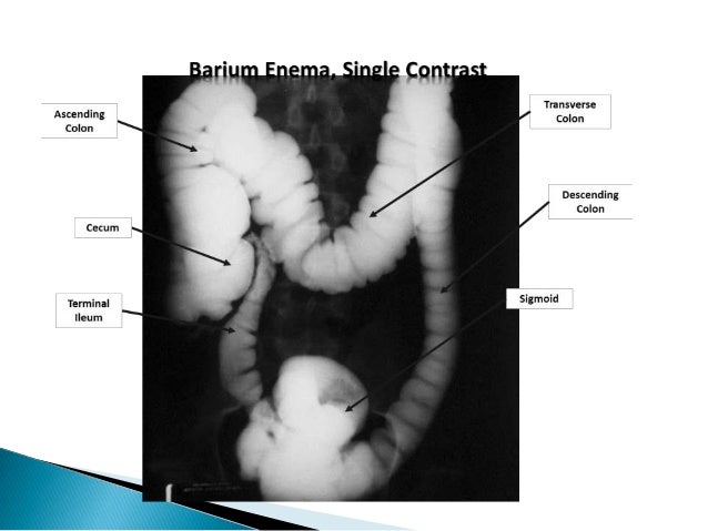 Radiographic anatomy of gastrointestinal tract