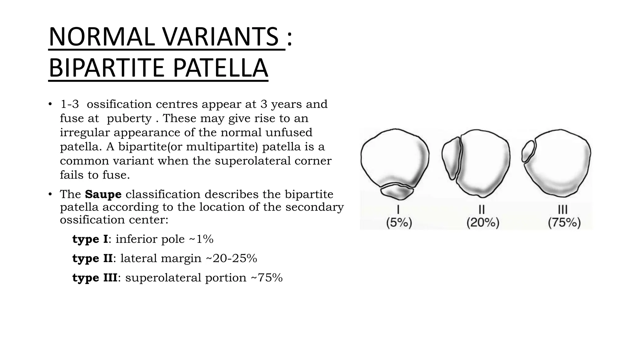RADIOGRAPHIC ANATOMY OF KNEE JOINT AND ITS RADIOGRAPHIC VIEWS.pptx