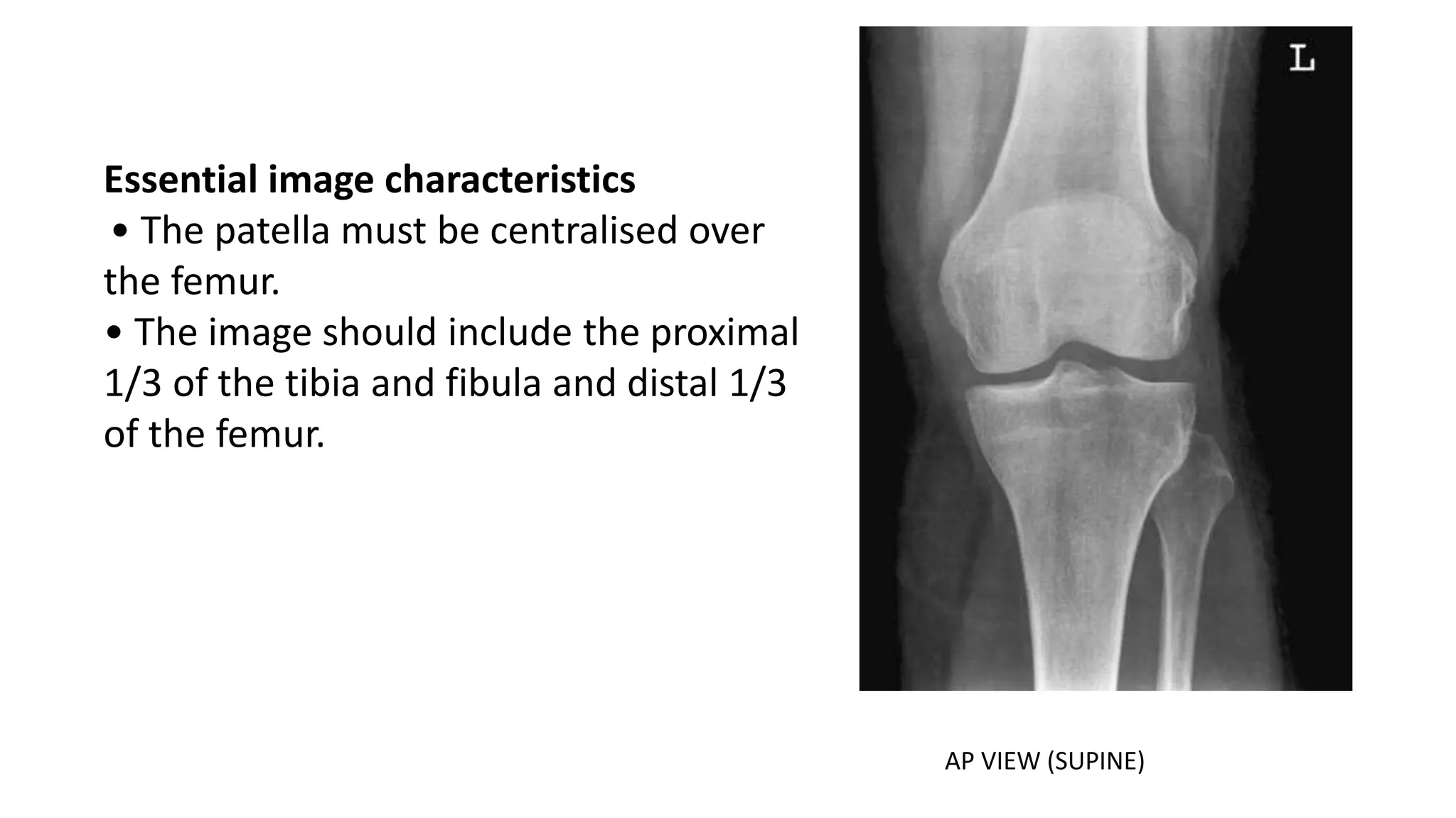 RADIOGRAPHIC ANATOMY OF KNEE JOINT AND ITS RADIOGRAPHIC VIEWS.pptx