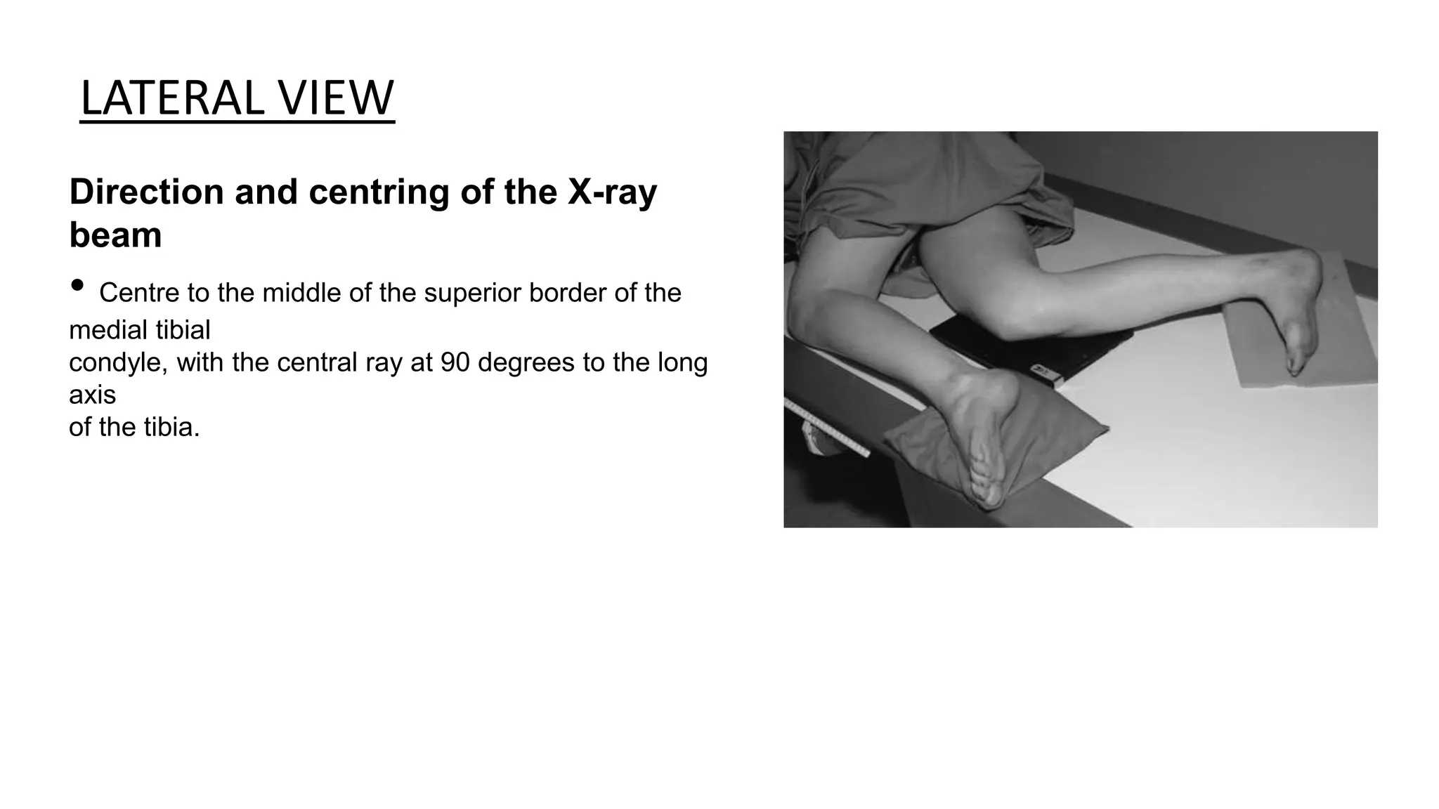 RADIOGRAPHIC ANATOMY OF KNEE JOINT AND ITS RADIOGRAPHIC VIEWS.pptx ...