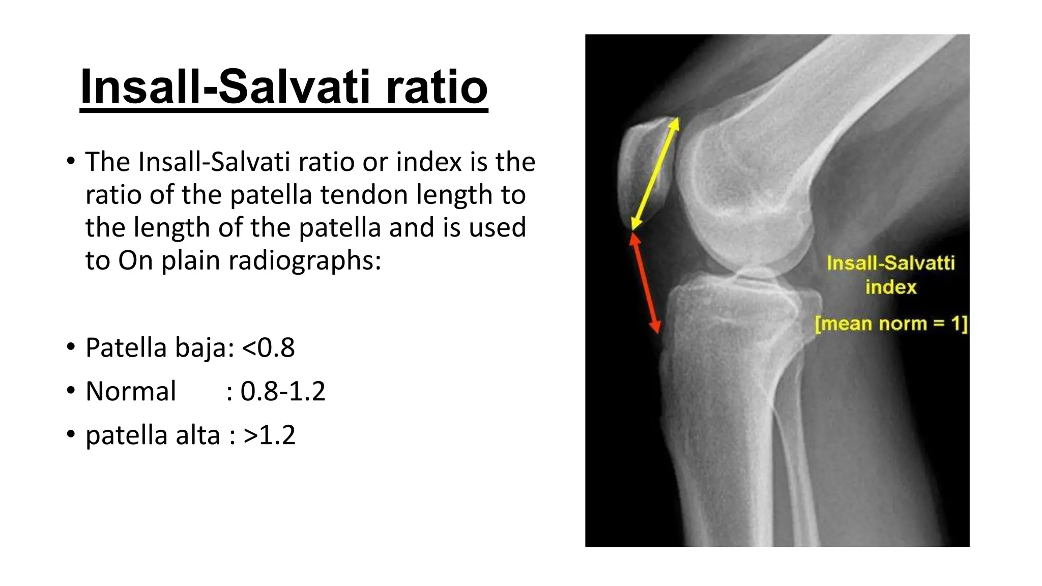 RADIOGRAPHIC ANATOMY OF KNEE JOINT AND ITS RADIOGRAPHIC VIEWS.pptx