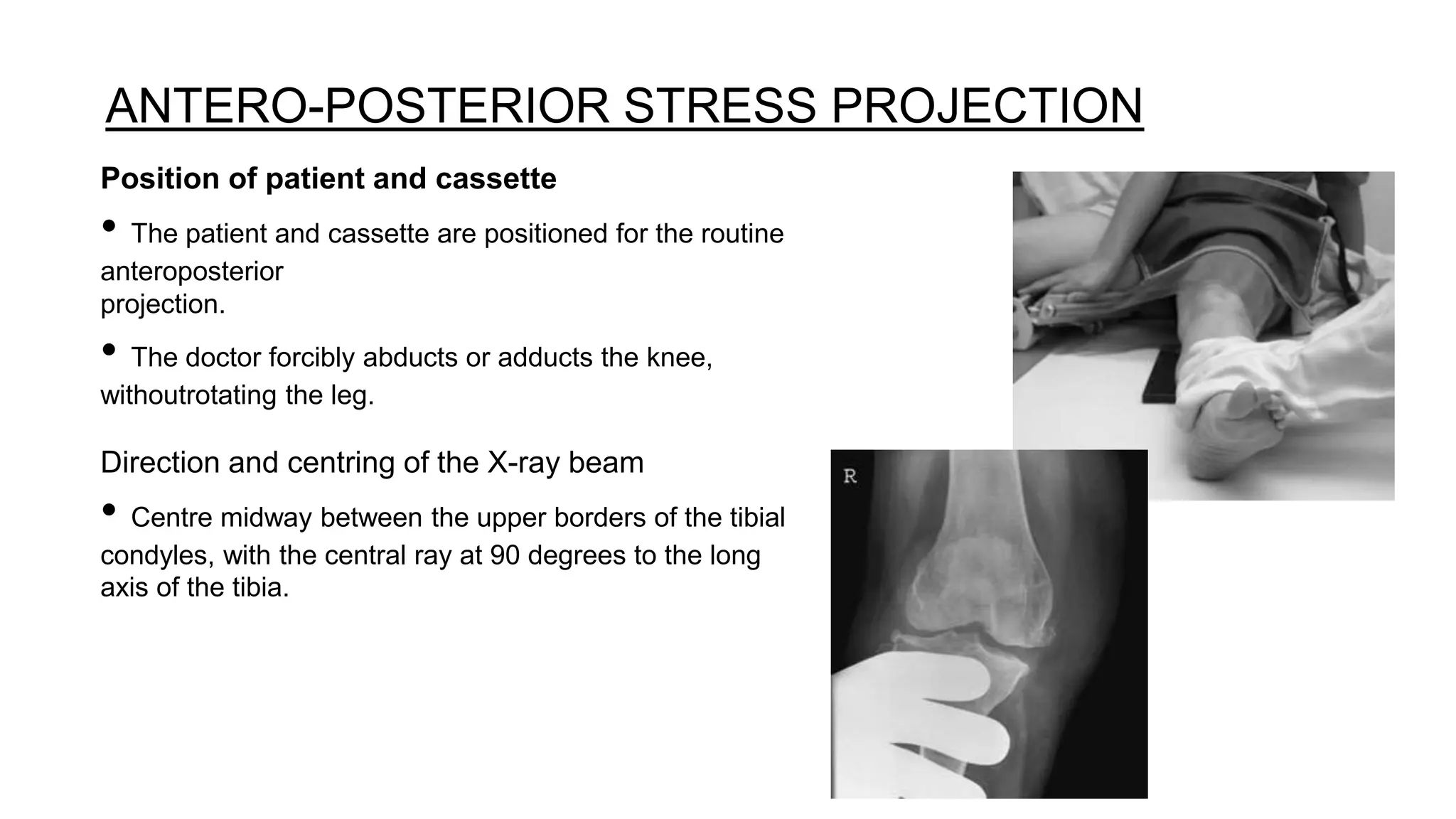 RADIOGRAPHIC ANATOMY OF KNEE JOINT AND ITS RADIOGRAPHIC VIEWS.pptx
