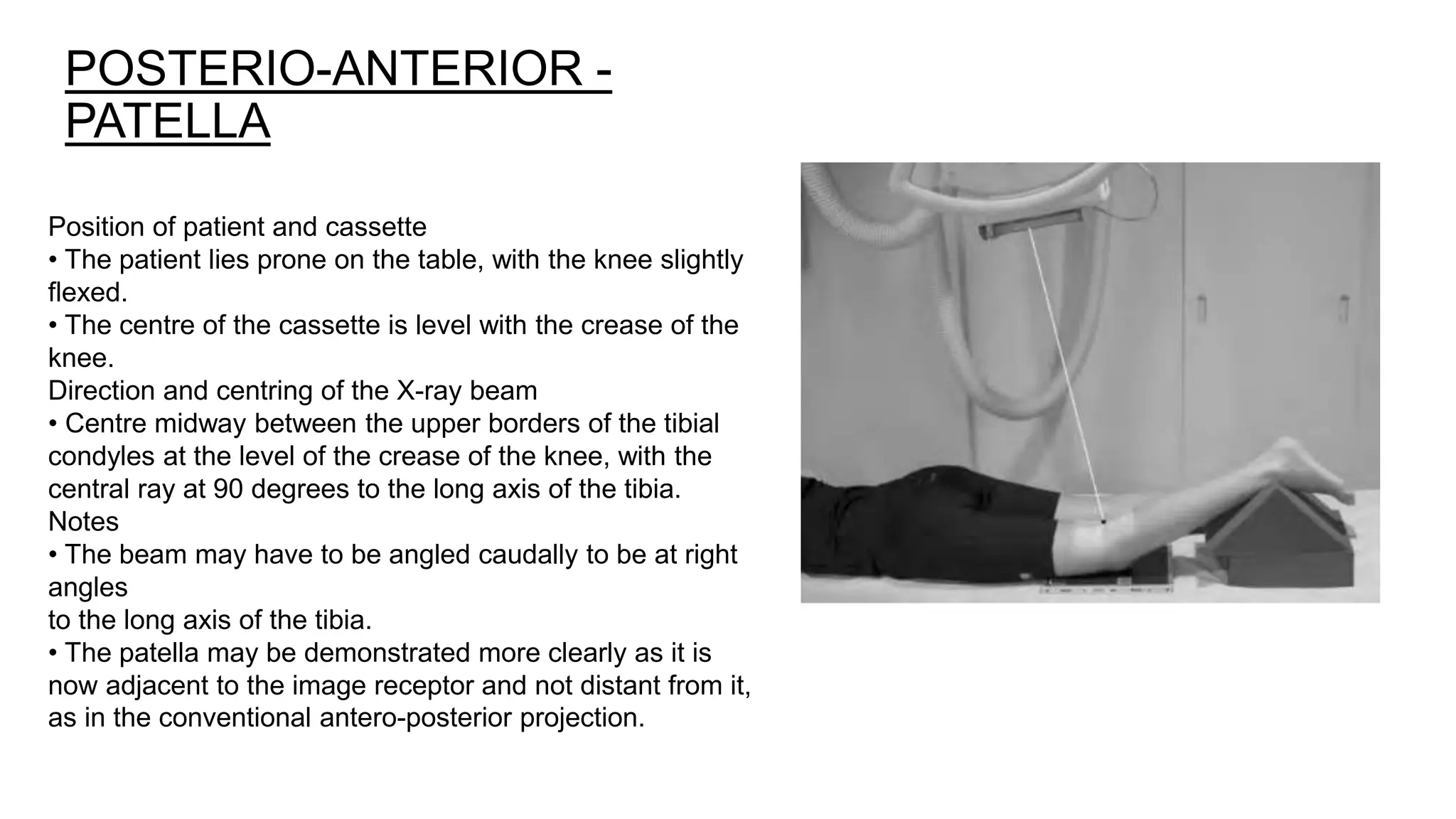 RADIOGRAPHIC ANATOMY OF KNEE JOINT AND ITS RADIOGRAPHIC VIEWS.pptx