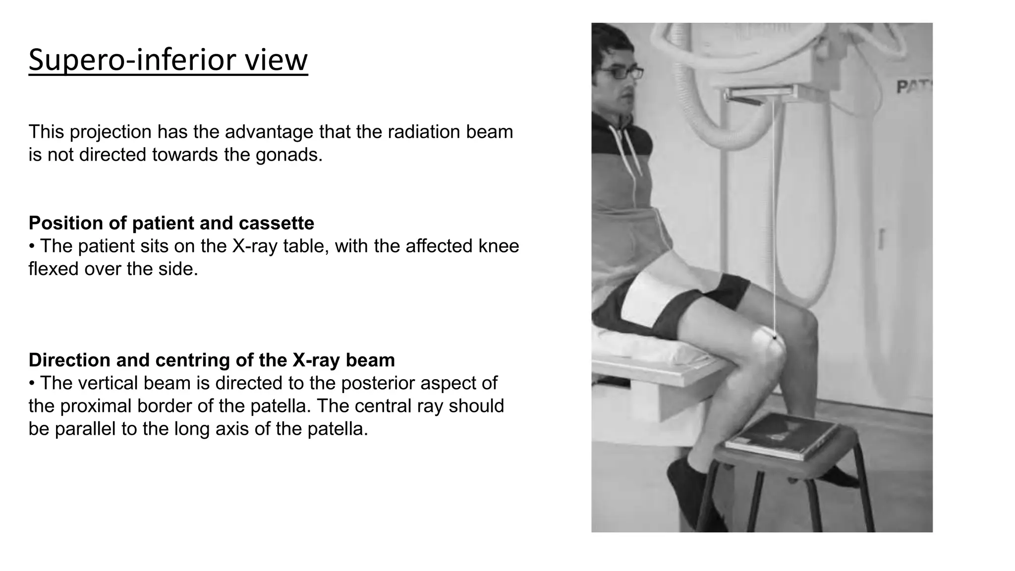 RADIOGRAPHIC ANATOMY OF KNEE JOINT AND ITS RADIOGRAPHIC VIEWS.pptx