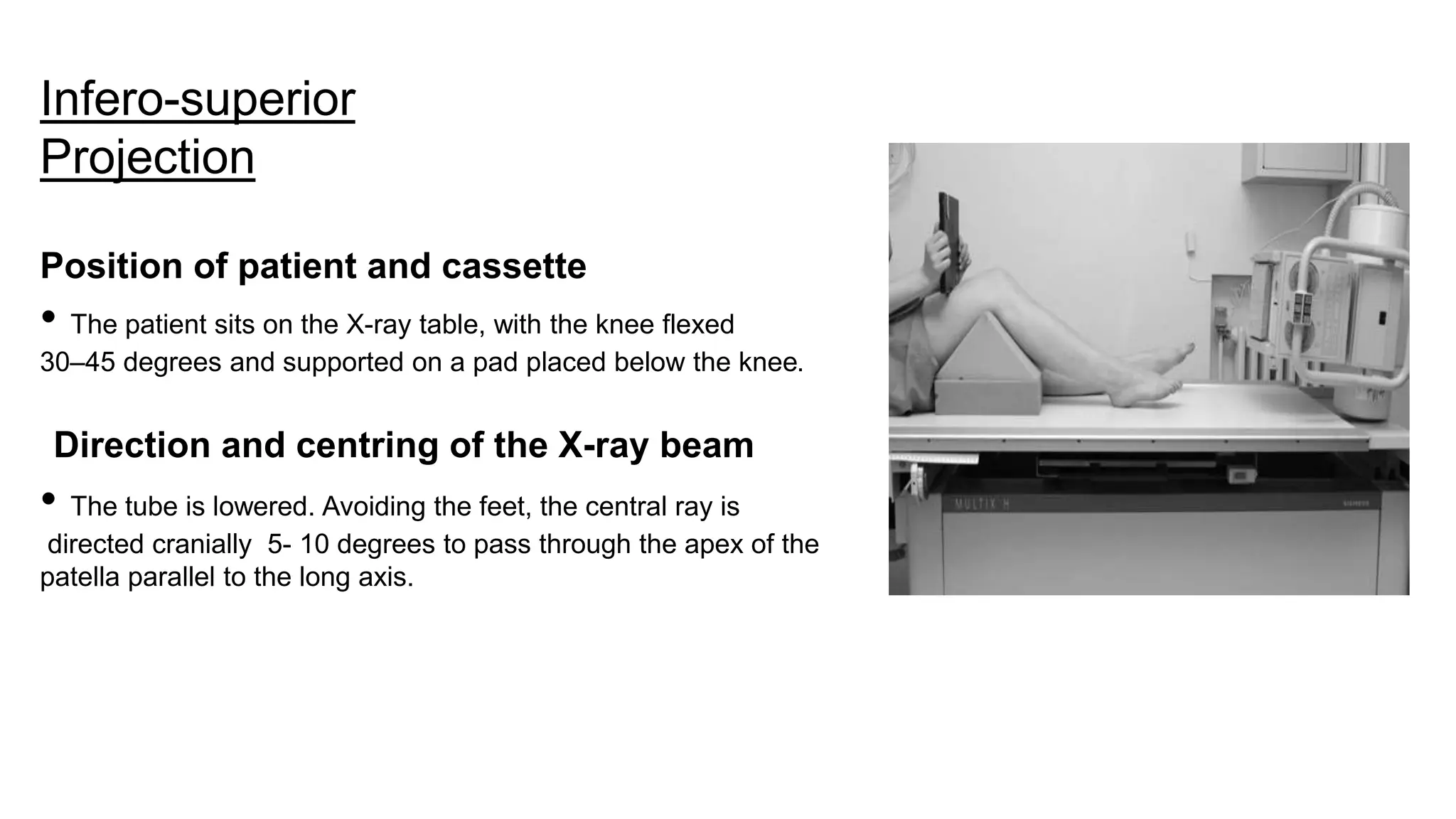 RADIOGRAPHIC ANATOMY OF KNEE JOINT AND ITS RADIOGRAPHIC VIEWS.pptx