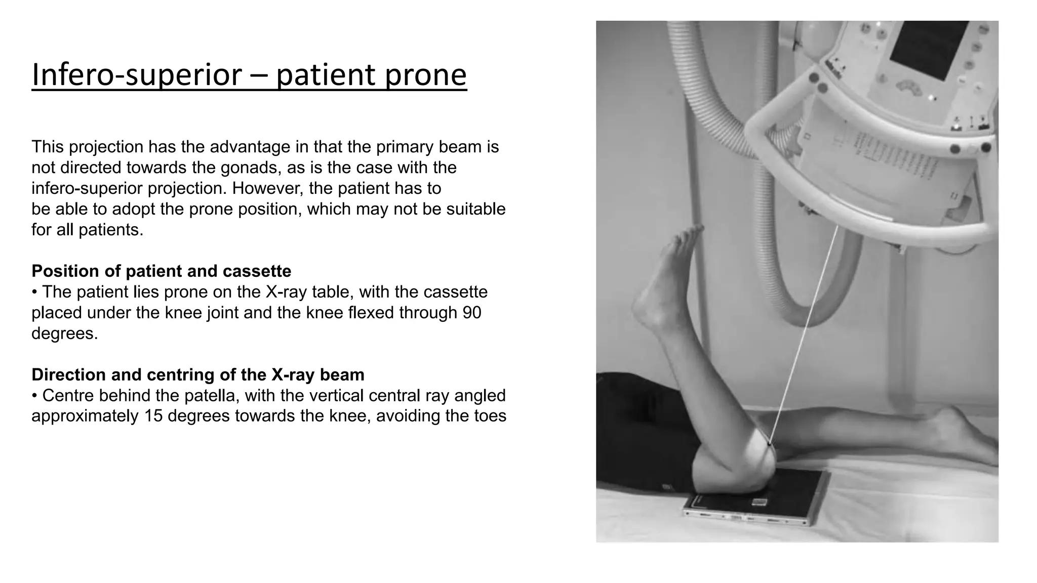 RADIOGRAPHIC ANATOMY OF KNEE JOINT AND ITS RADIOGRAPHIC VIEWS.pptx