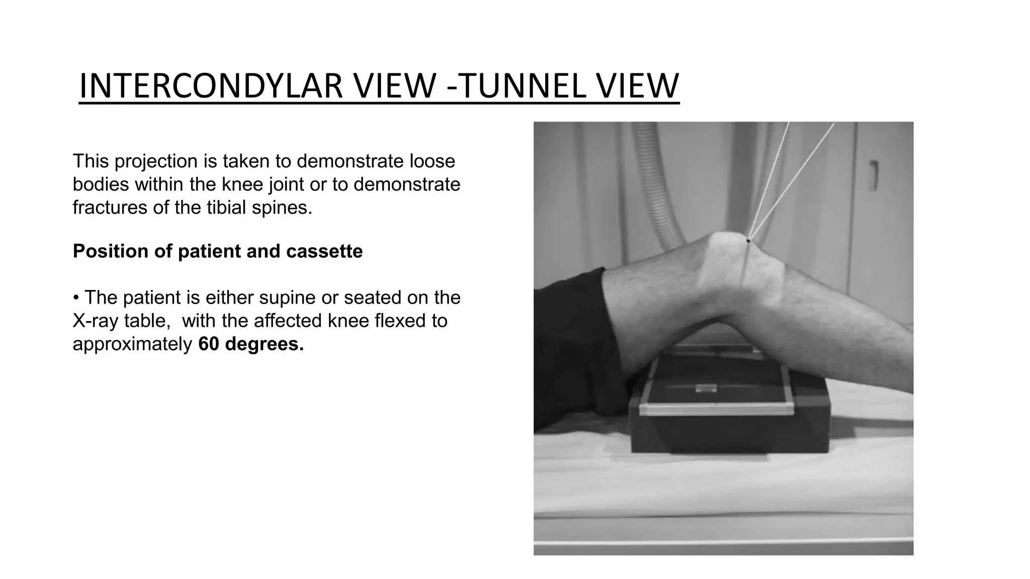 RADIOGRAPHIC ANATOMY OF KNEE JOINT AND ITS RADIOGRAPHIC VIEWS.pptx