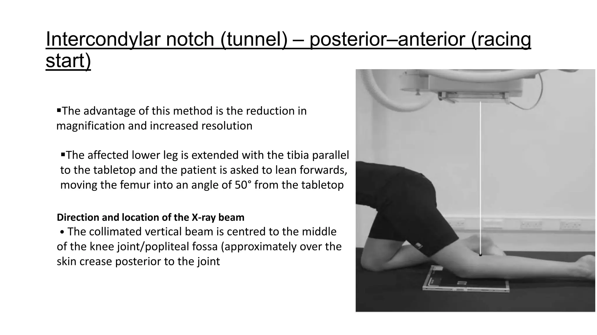 RADIOGRAPHIC ANATOMY OF KNEE JOINT AND ITS RADIOGRAPHIC VIEWS.pptx