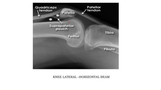 RADIOGRAPHIC ANATOMY OF KNEE JOINT AND ITS RADIOGRAPHIC VIEWS.pptx