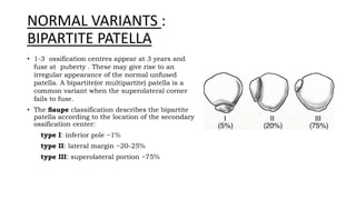 RADIOGRAPHIC ANATOMY OF KNEE JOINT AND ITS RADIOGRAPHIC VIEWS.pptx ...