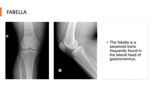 RADIOGRAPHIC ANATOMY OF KNEE JOINT AND ITS RADIOGRAPHIC VIEWS.pptx ...