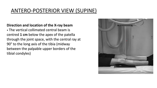 RADIOGRAPHIC ANATOMY OF KNEE JOINT AND ITS RADIOGRAPHIC VIEWS.pptx ...