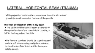 RADIOGRAPHIC ANATOMY OF KNEE JOINT AND ITS RADIOGRAPHIC VIEWS.pptx