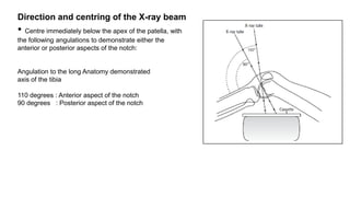 RADIOGRAPHIC ANATOMY OF KNEE JOINT AND ITS RADIOGRAPHIC VIEWS.pptx