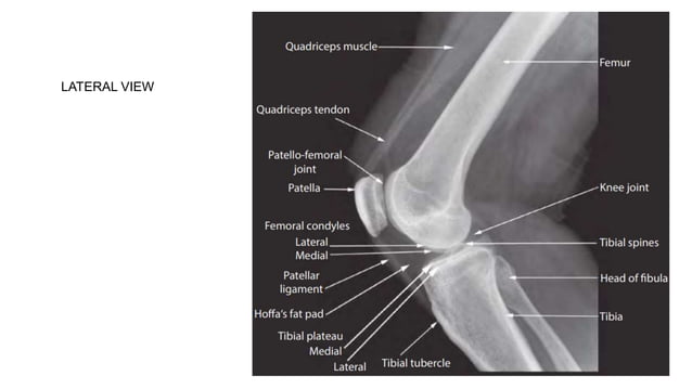 RADIOGRAPHIC ANATOMY OF KNEE JOINT AND ITS RADIOGRAPHIC VIEWS.pptx ...