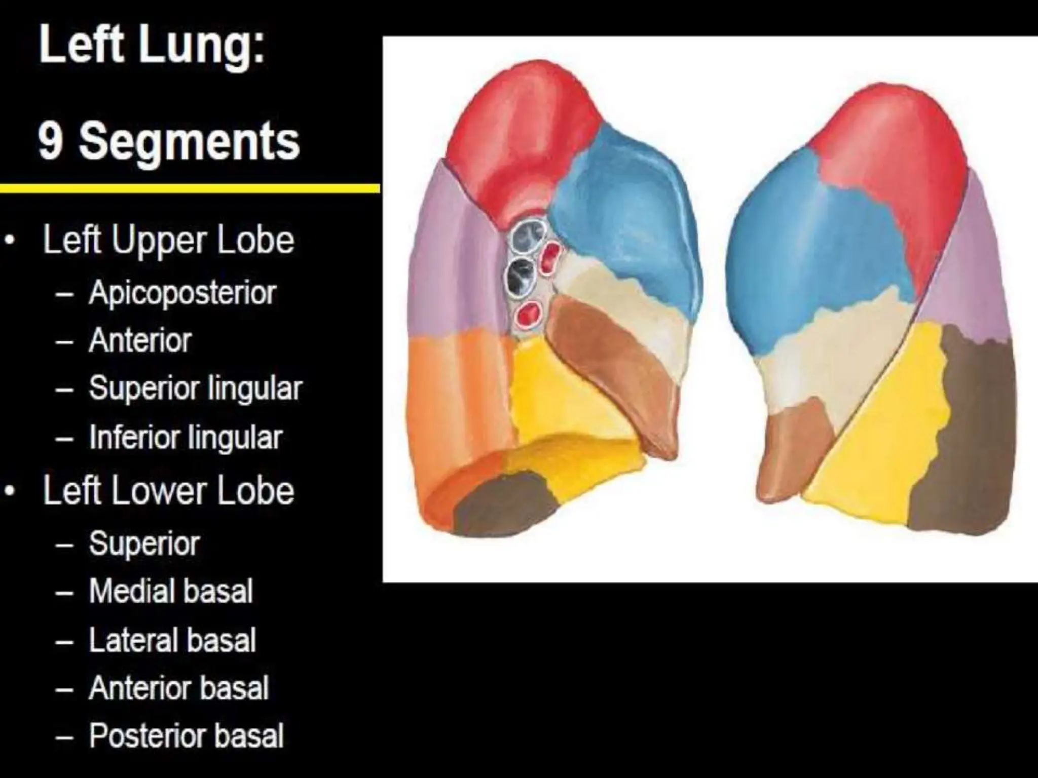 Radiographic anatomy of lungs.pptx