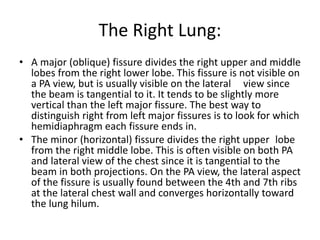 Radiographic anatomy of lungs.pptx