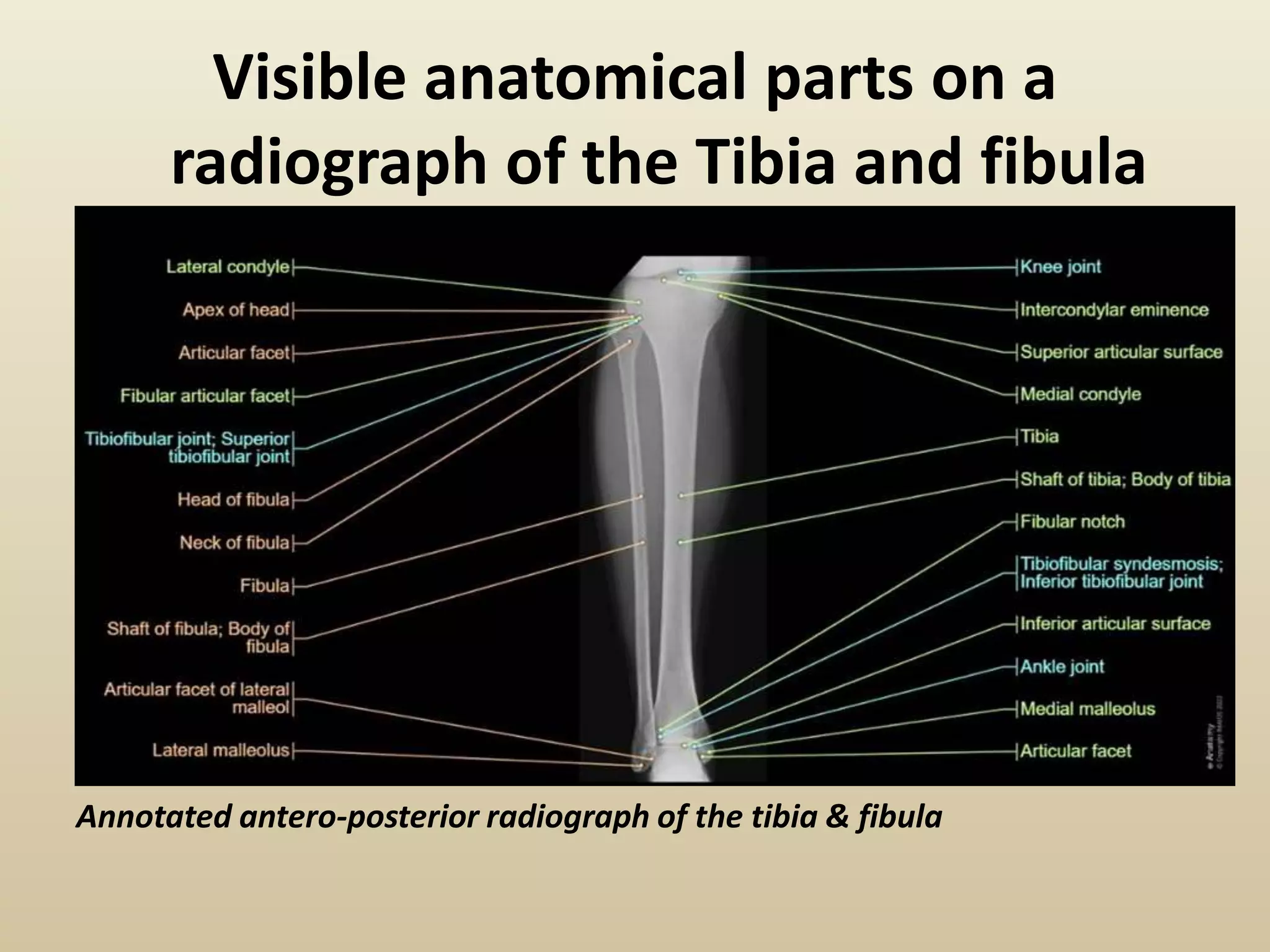 Radiographic Anatomy of the Lower Limbs.pptx