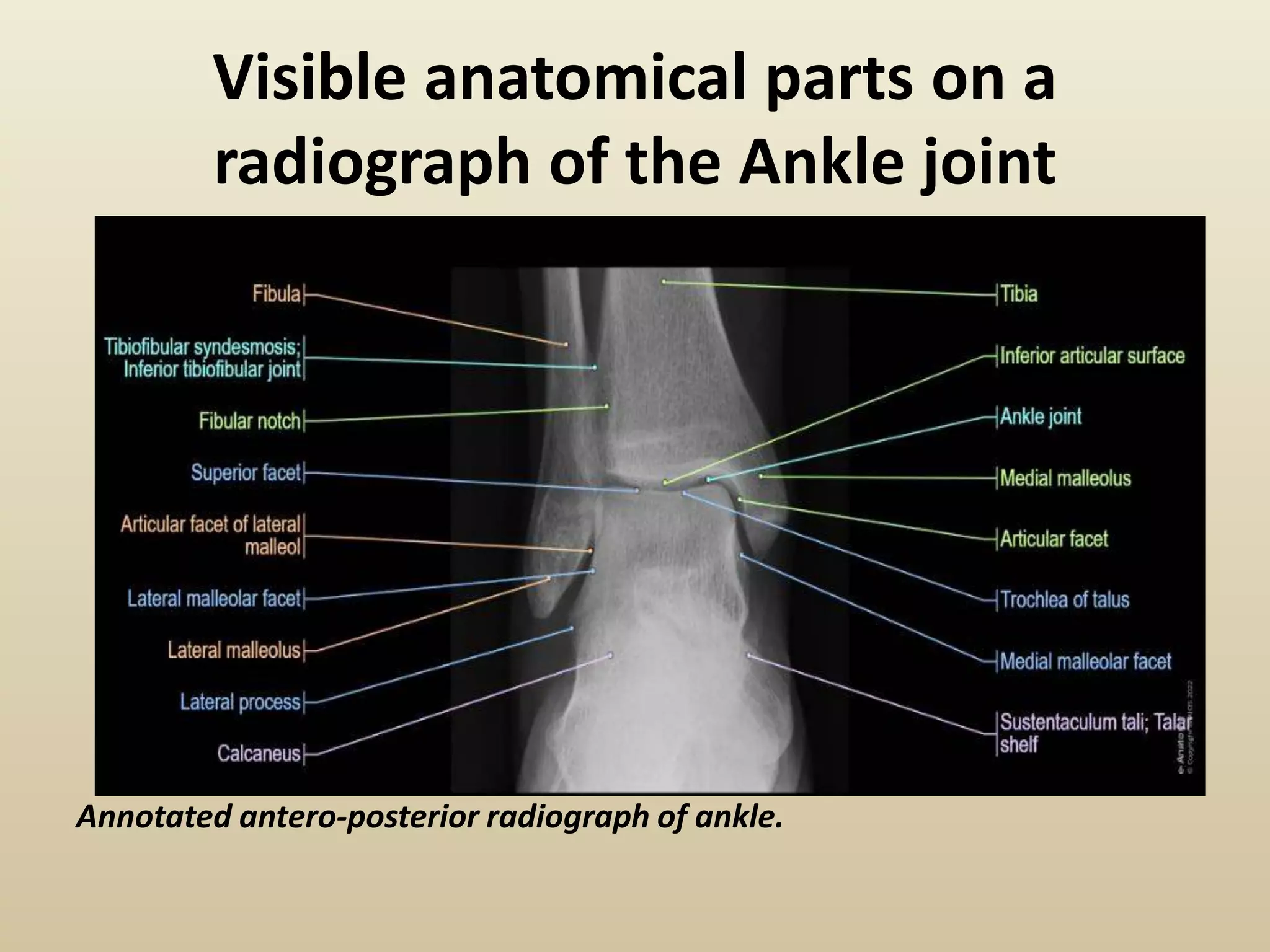 Radiographic Anatomy of the Lower Limbs.pptx