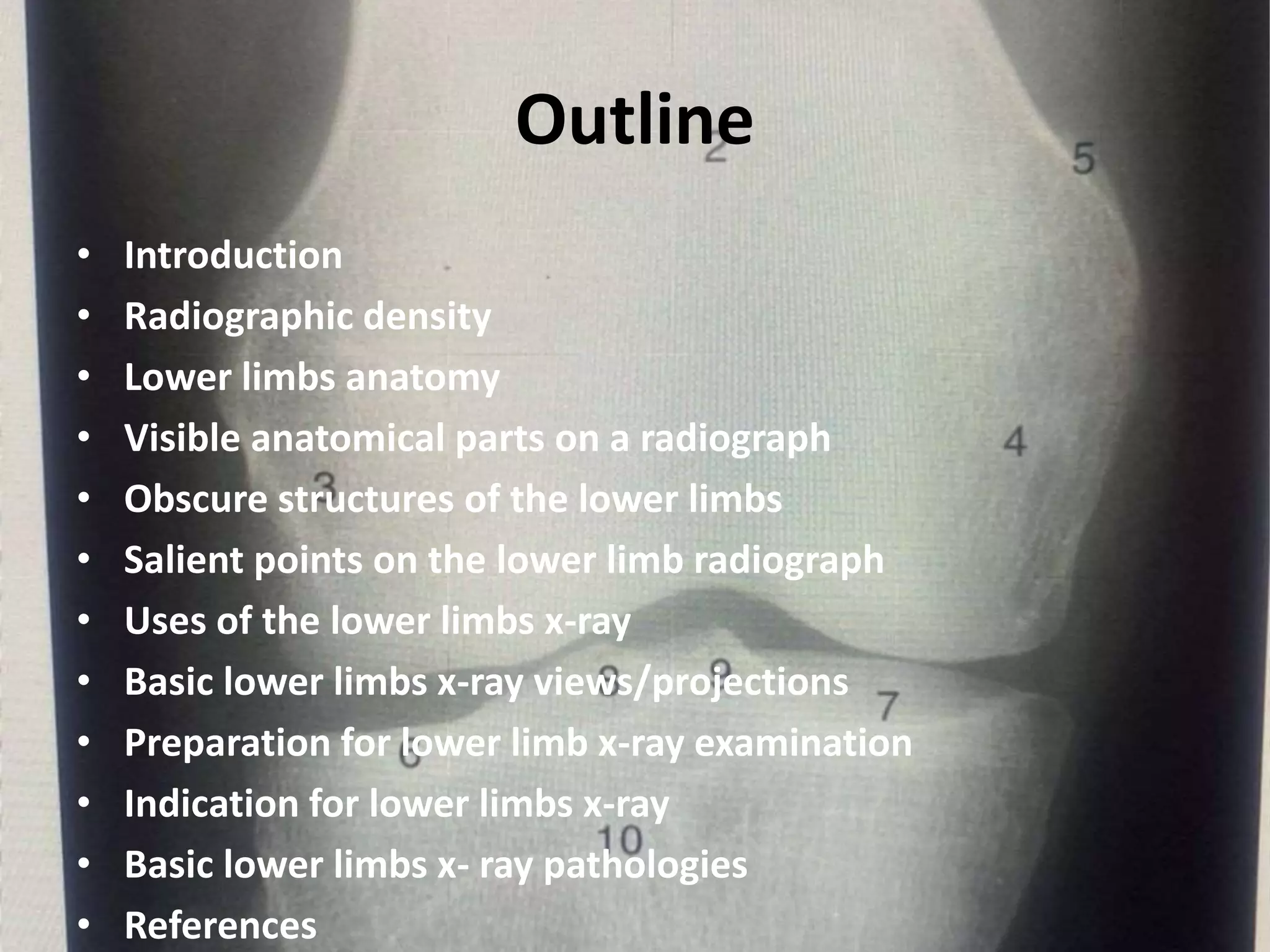 Radiographic Anatomy of the Lower Limbs.pptx