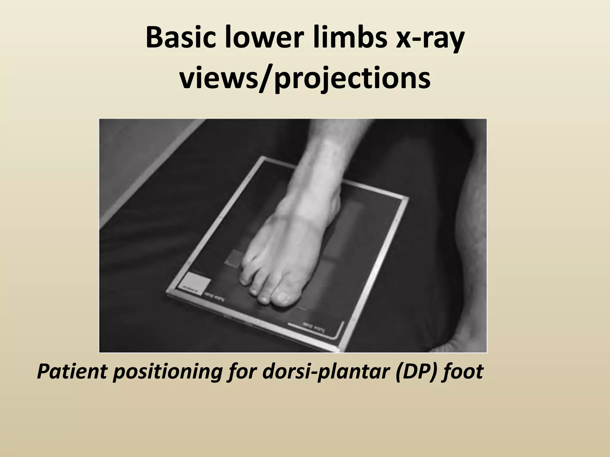 Radiographic Anatomy of the Lower Limbs.pptx