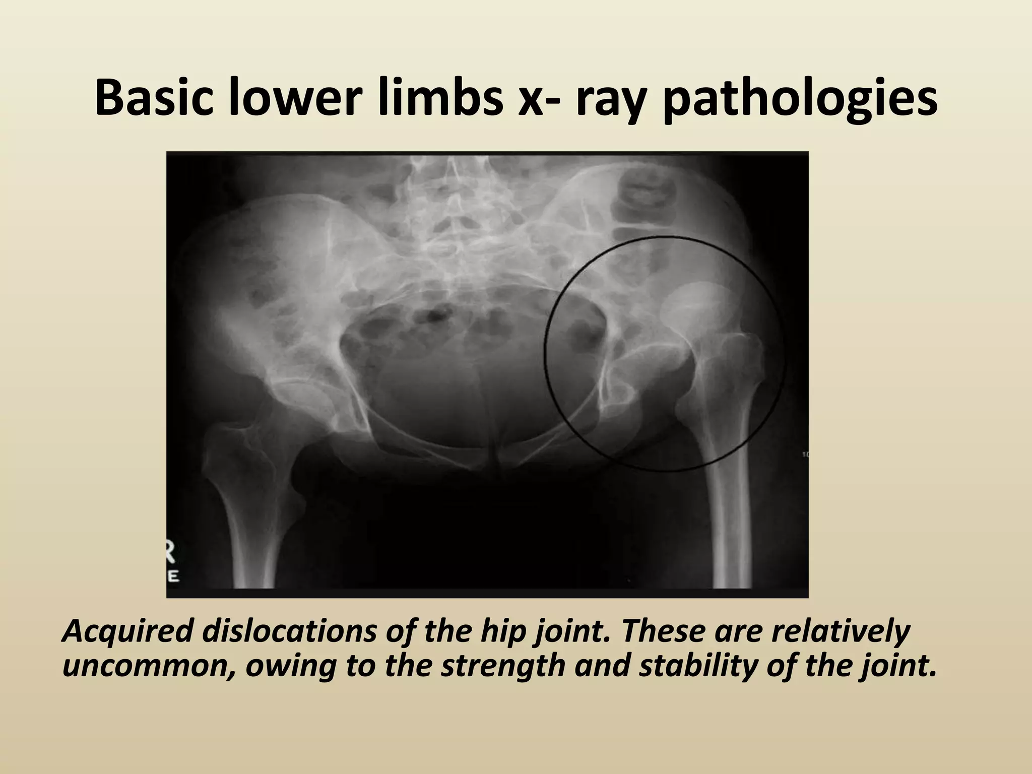 Radiographic Anatomy of the Lower Limbs.pptx