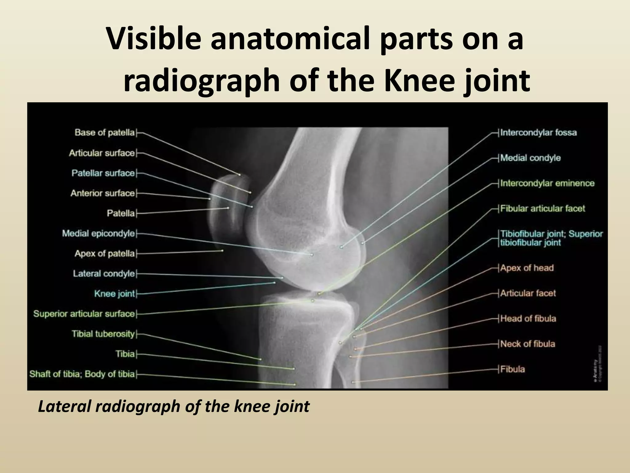 Radiographic Anatomy of the Lower Limbs.pptx