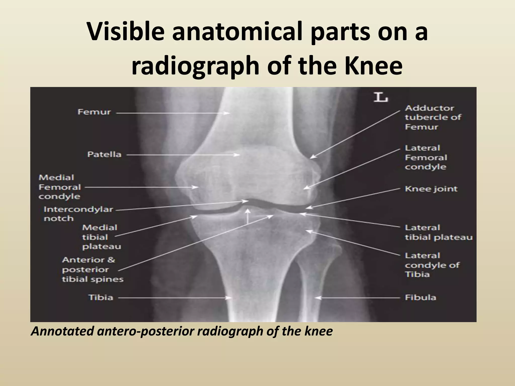 Radiographic Anatomy of the Lower Limbs.pptx