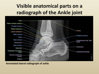 Radiographic Anatomy of the Lower Limbs.pptx