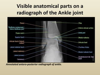 Radiographic Anatomy of the Lower Limbs.pptx